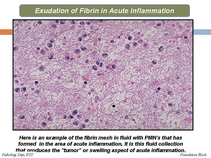 PRACTICAL 2 CELL INJURY INFLAMMATION II I Acute