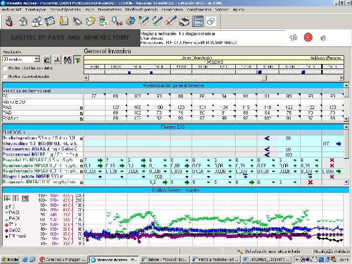 Measuring abdominal compliance for laparoscopic procedures Jan Mulier