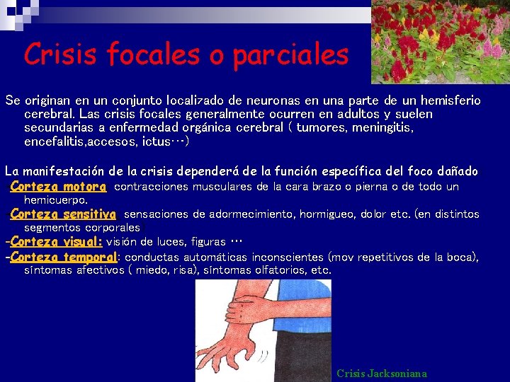 EPILEPSIA Definicin n Etiologa Fisiopatologa n Clasificacin n