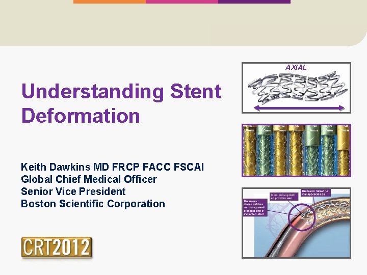 AXIAL Understanding Stent Deformation Keith Dawkins MD FRCP