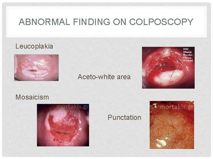 ALL ABOUT CERVIX KARIMA SALAMA CONTENTS Anatomy Etiology