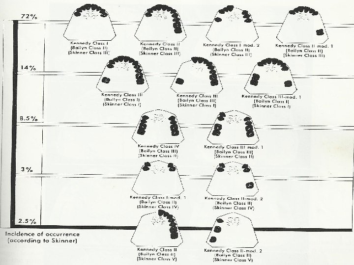 Classification of partially edentulous arches REQUIREMENTS OF AN