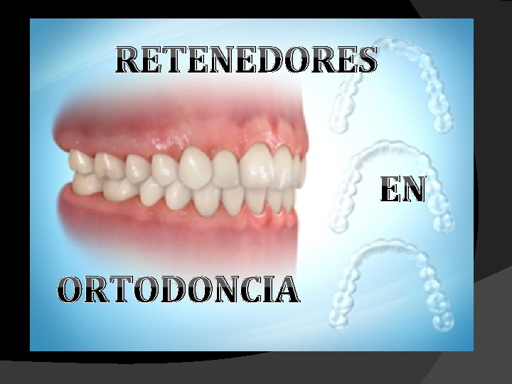 RETENEDORES EN ORTODONCIA RETENEDORES A medida que los