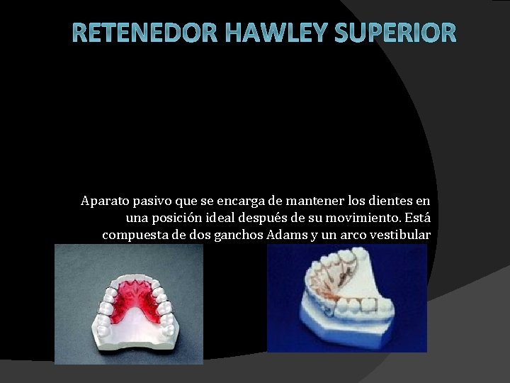 RETENEDORES EN ORTODONCIA RETENEDORES A medida que los