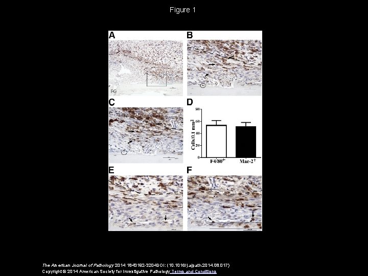 Fracture Healing via Periosteal Callus Formation Requires Macrophages