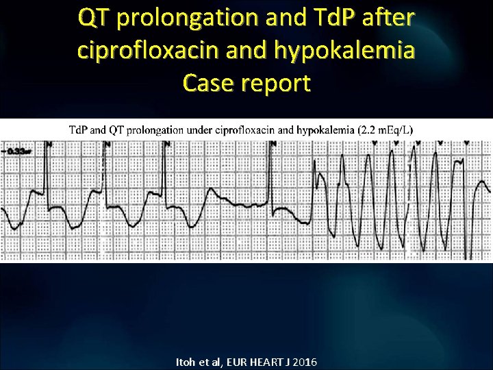 QT prolongation and Td P after ciprofloxacin and