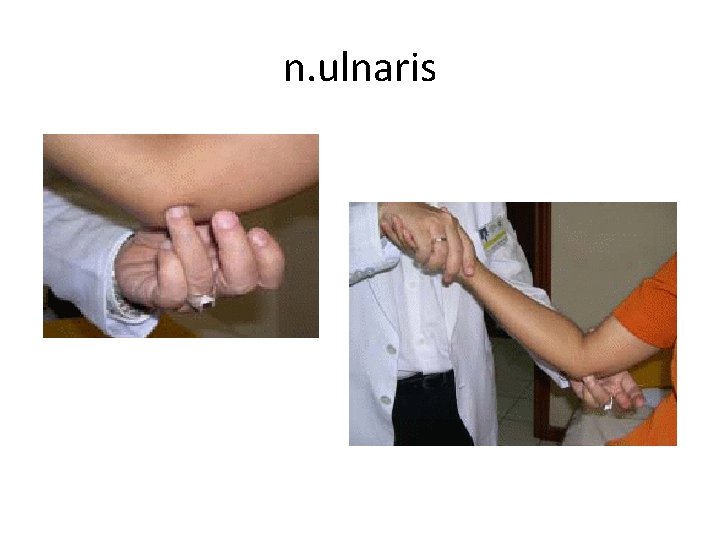 Clinical skill Morbus Hansen GAMBARAN KLINIK DAN KLASIFIKASI