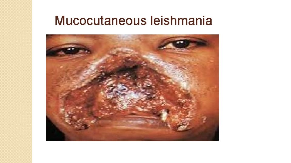 Pathology of infectious diseases LEC 4 Learning objectives