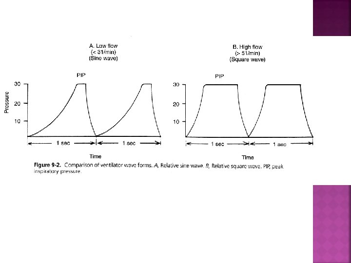 PPV Positive Pressure Ventilation by dr behzad barekatain