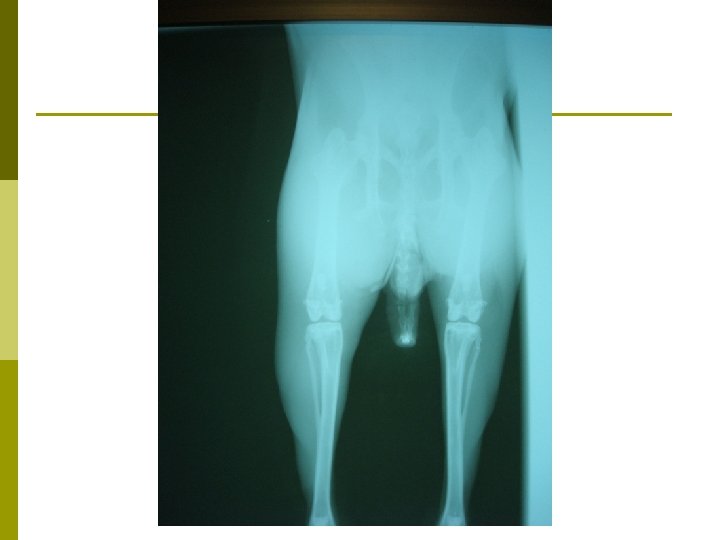 IM Lumbar muscles p Intramuscular injections may be