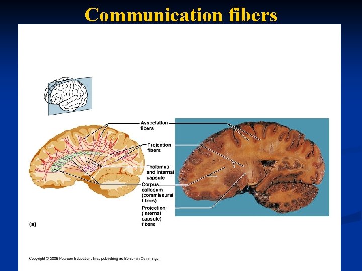 Chapter 15 The Brain and Cranial Nerves The