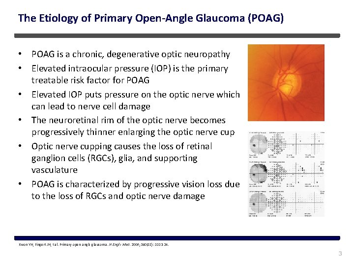 Changing Perspectives in Glaucoma Management In Combination with