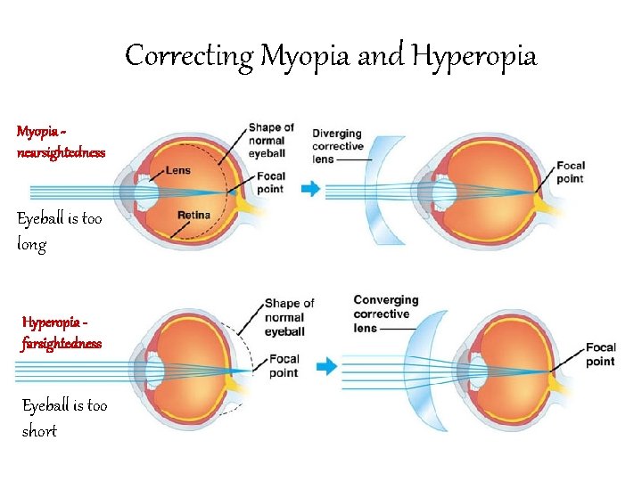 The Senses Sensory Receptors Five general categories Pain