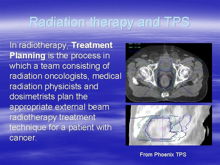 Comparing the Streamline Diffusion Method and Bipartition Model