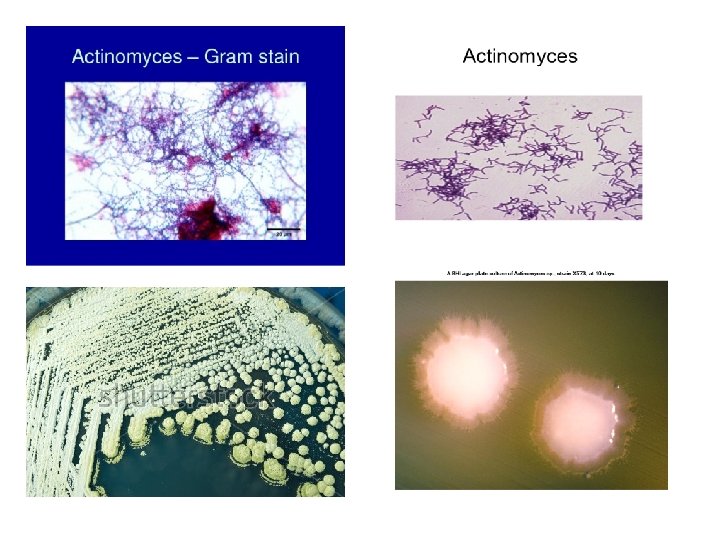 CORNEBACTERIUM INFECTIONS FAMILY Corynebacteriaceae Genus ...