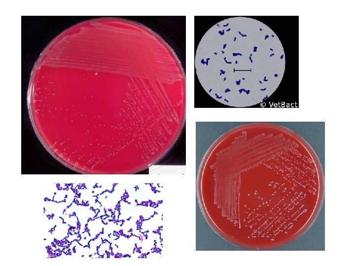 CORNEBACTERIUM INFECTIONS FAMILY Corynebacteriaceae Genus ...