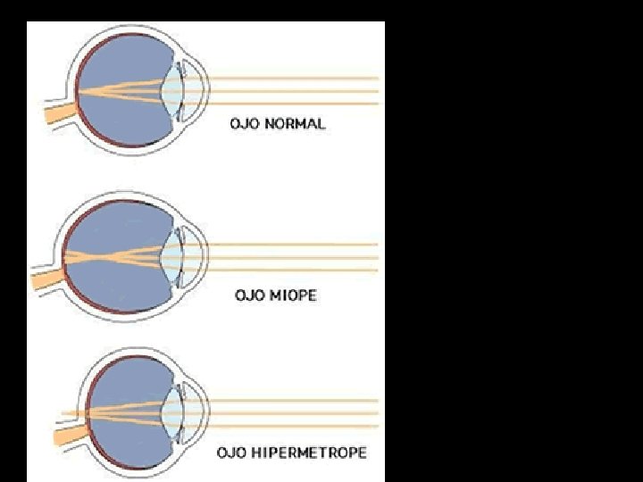 OPTICA Intensidad luminosa Candela La candela es una