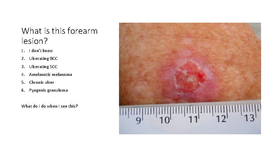 Skin Cancer A few questions A few photos