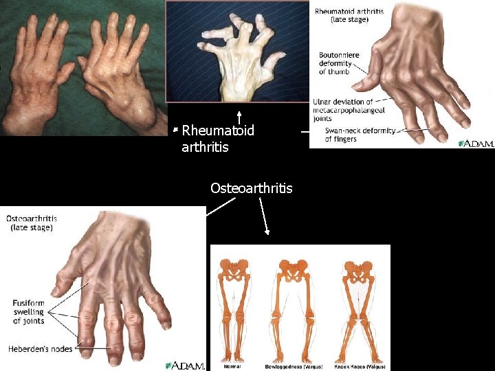 Skeletal System Skeletal System 206 bones Functions n