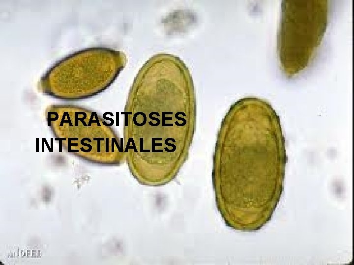 PARASITOSES INTESTINALES Plan I Introduction II Ascaridiose III