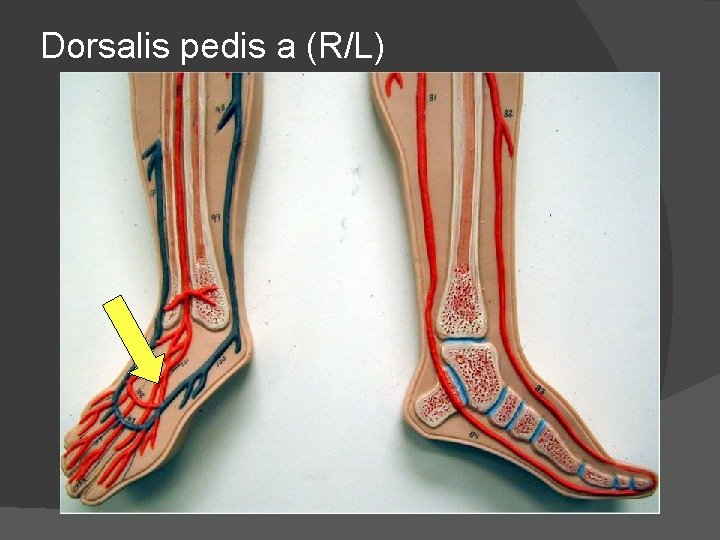 CARDIOVASCULAR MAJOR ARTERIES Neck Head Brain Aorta Brachiocephalic