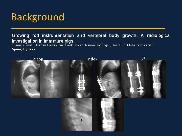 Vertebral Body Growth During Growing Rod Instrumentation Growth