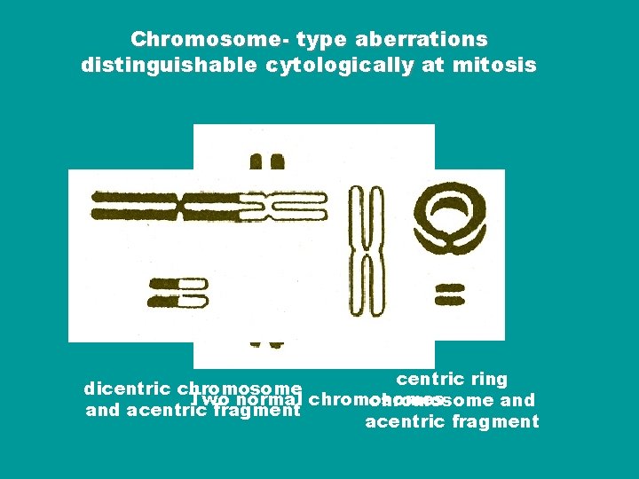 Chromosome aberration analysis in peripheral lymphocytes of Gulf