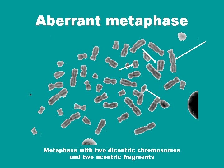 Chromosome aberration analysis in peripheral lymphocytes of Gulf