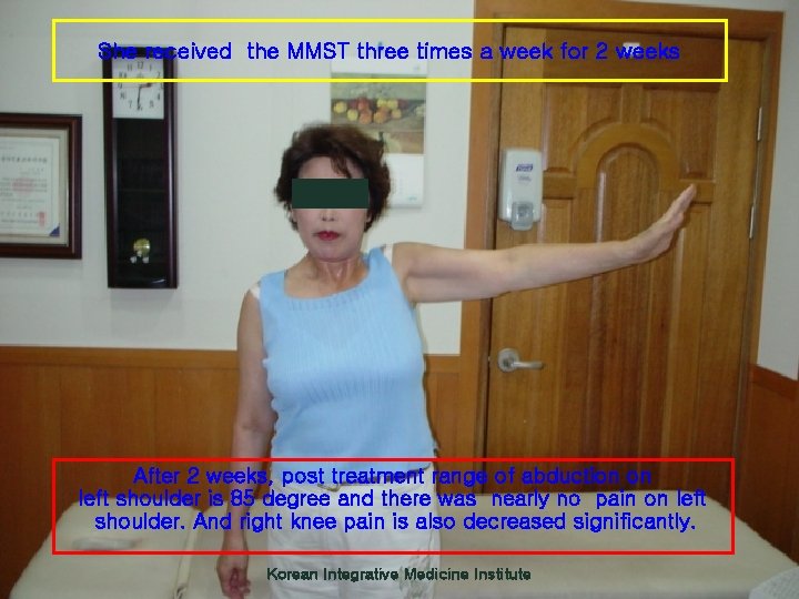 Myofascial Meridian Stimulation Therapy Case Study The MMST