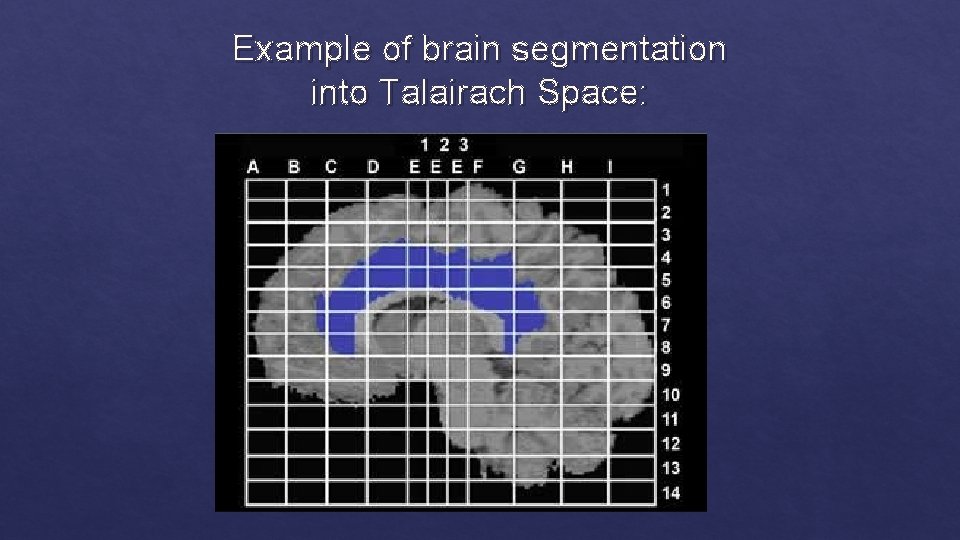 A new high resolution dynamic interactive neuro anatomic
