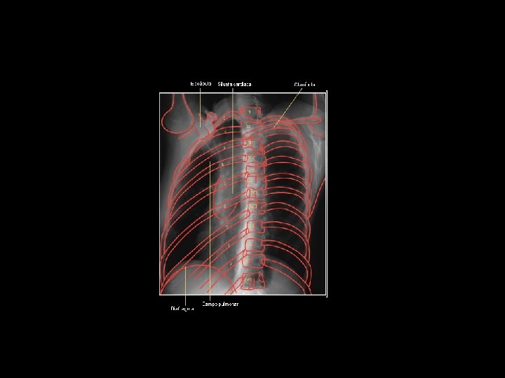 RADIOLOGIA DEL CORAZON Interpretar las diferentes proyecciones radiolgicas