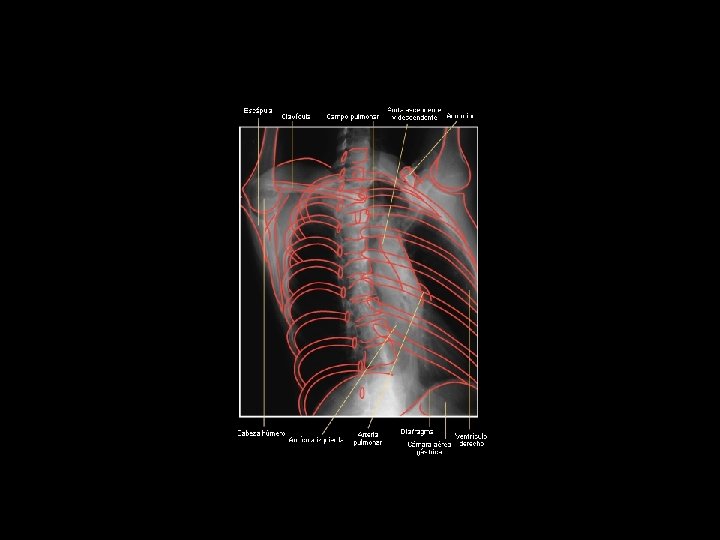 RADIOLOGIA DEL CORAZON Interpretar las diferentes proyecciones radiolgicas