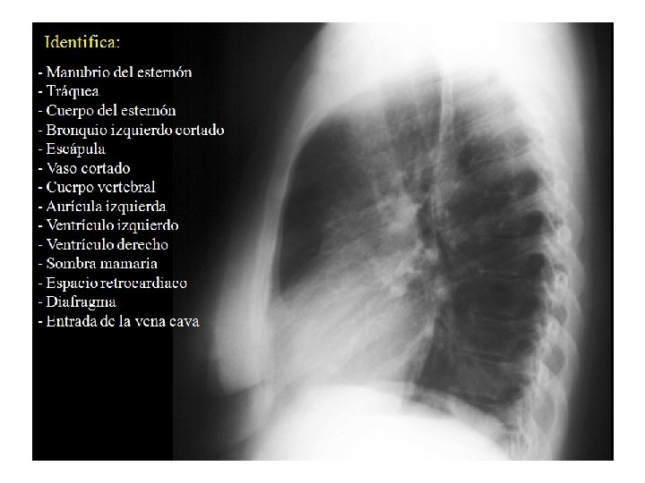 RADIOLOGIA DEL CORAZON Interpretar las diferentes proyecciones radiolgicas