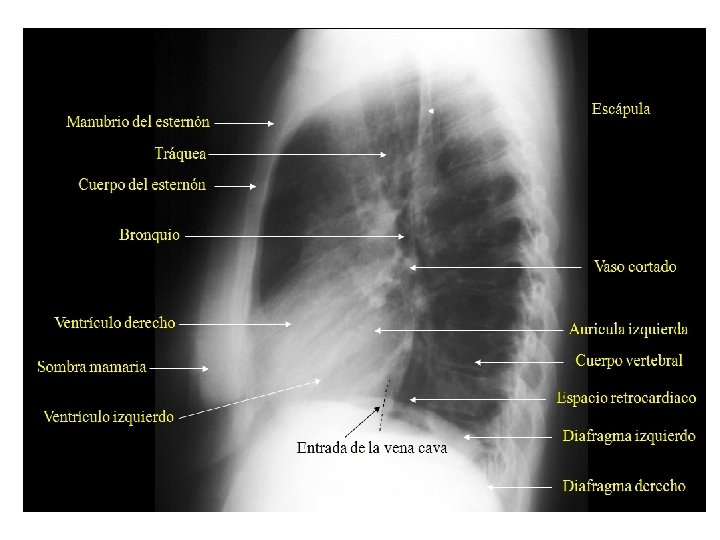 RADIOLOGIA DEL CORAZON Interpretar las diferentes proyecciones radiolgicas
