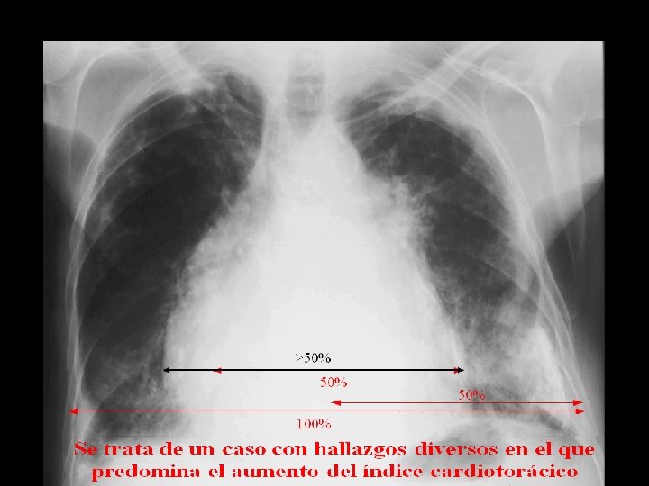 RADIOLOGIA DEL CORAZON Interpretar las diferentes proyecciones radiolgicas