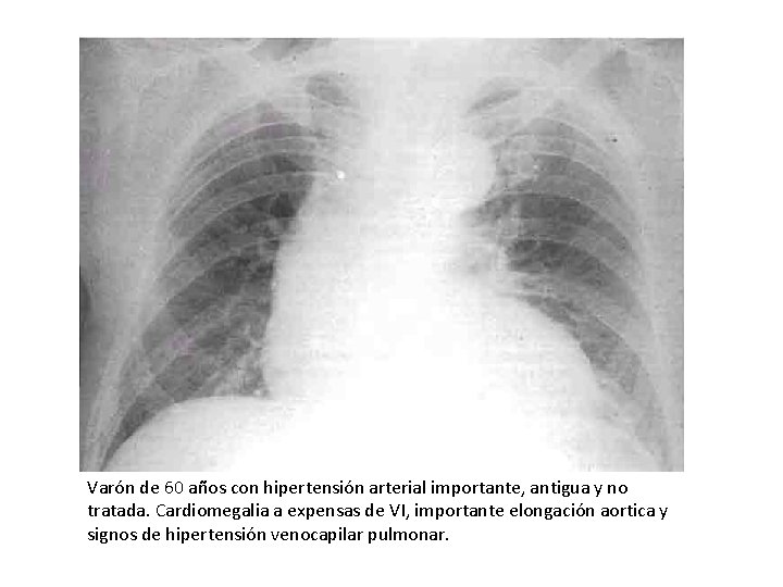 RADIOLOGIA DEL CORAZON Interpretar las diferentes proyecciones radiolgicas