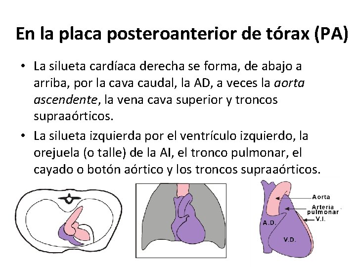 RADIOLOGIA DEL CORAZON Interpretar las diferentes proyecciones radiolgicas