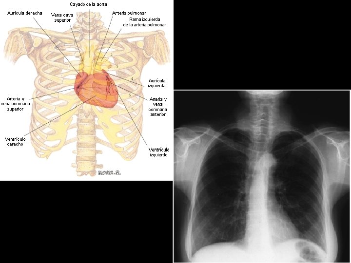 RADIOLOGIA DEL CORAZON Interpretar las diferentes proyecciones radiolgicas