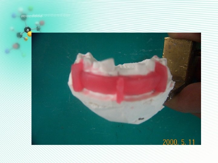 Construction bite Class 2 Class 3 2 Activator