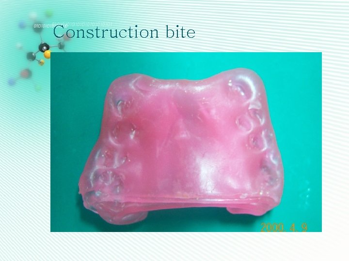 Construction bite Class 2 Class 3 2 Activator