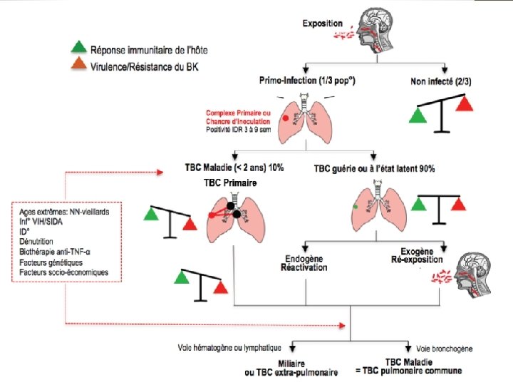 La Tuberculose cours IFSI 230920 Dr Anne Contis