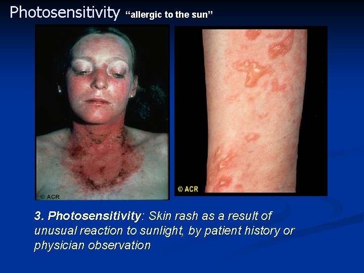 Case Report n A 44 yearold AfricanAmerican woman