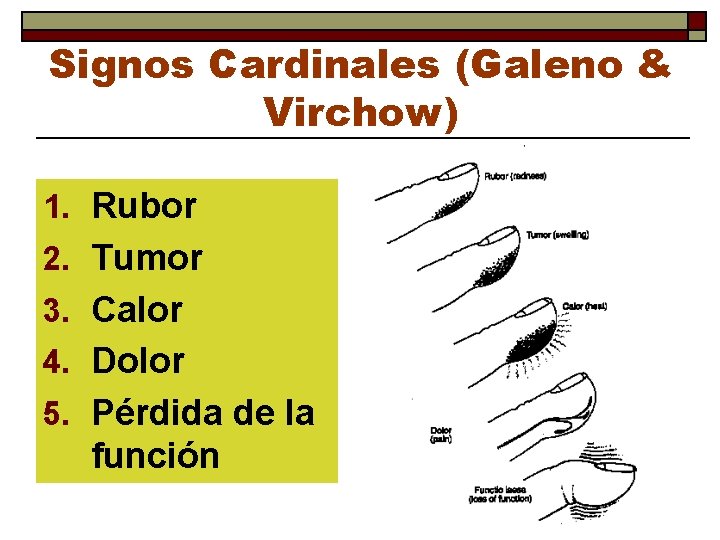 ASPECTOS BASICOS DE LA INFLAMACION Margarita Paz Curso