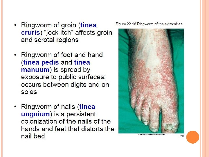 PATHOGENS WITH INTERMEDIATE VIRULENCE Dermatophytes Dermatophytes are fungi