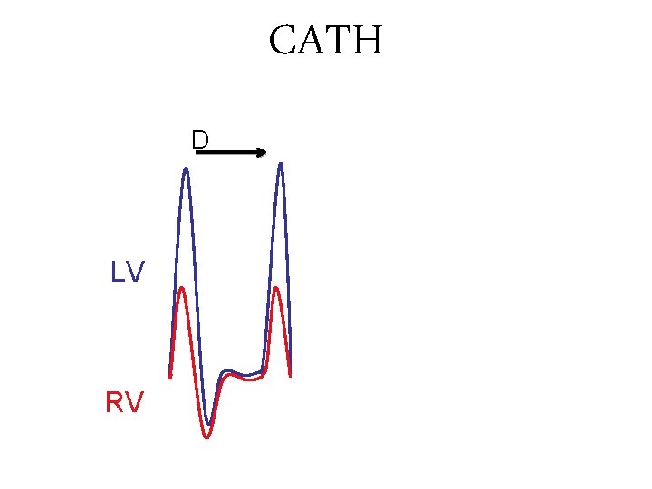 The Hemodynamics of Restrictive Constrictive Cardiomyopathy Jad Skaf