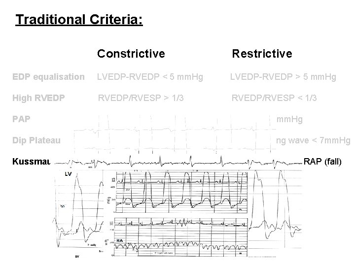 The Hemodynamics of Restrictive Constrictive Cardiomyopathy Jad Skaf