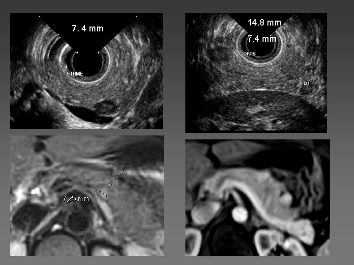 Place du radiologue dans la prise en charge
