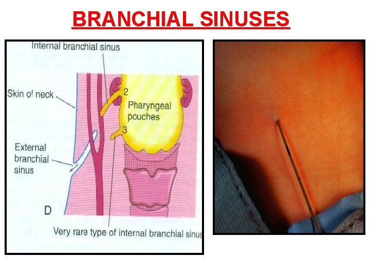 Pharyngeal arches Primitive pharynx stomodeum Hind brain vesicle