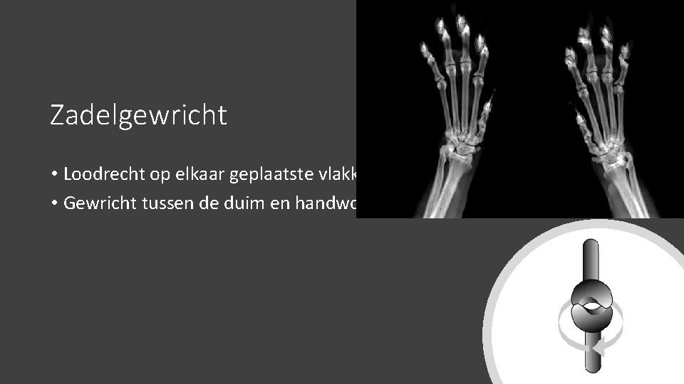 Botverbindingen en Gewrichten Leerdoelen Verschillende gewrichten ...