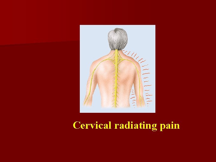 How to prevent cervical pain 1 Avoid highimpact
